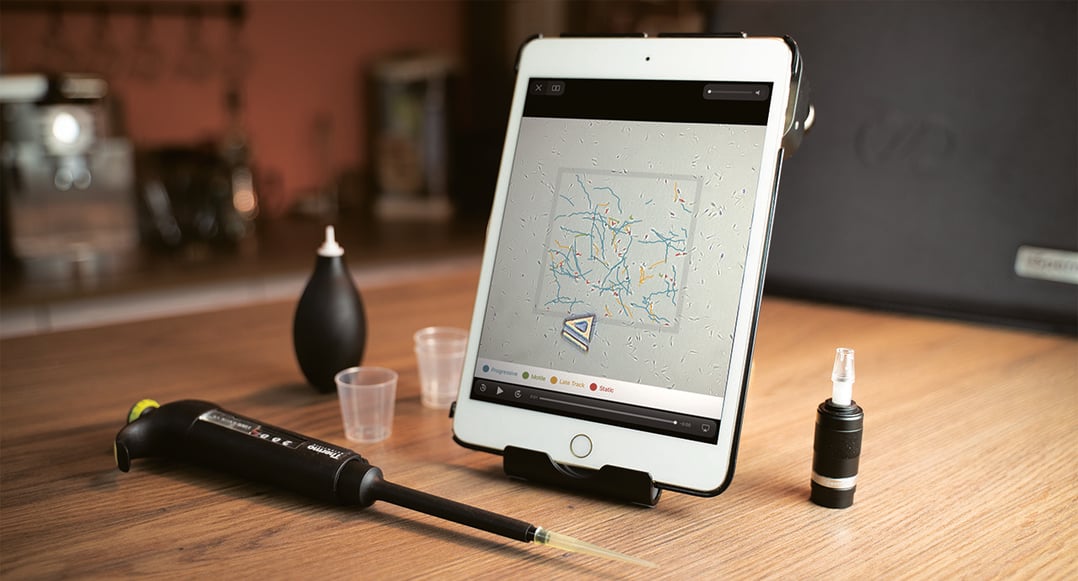 Semen Analysis Can be Easy, Objective, and Cost-Effective for Repro ...